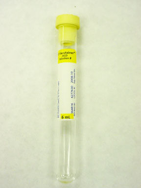 ACD-A Anticoagulant Solution Good Buffer Solutions Anticoagulant ...
